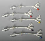 PEG Complications - Oral Cancer Foundation | Information and Resources ...